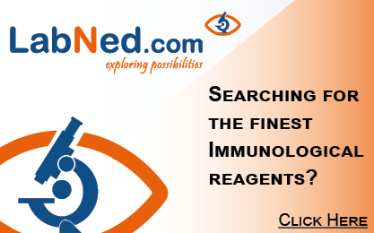 ImTec Diagnostics NV | the specialist in distributing laboratory supplies throughout Belgium and ...