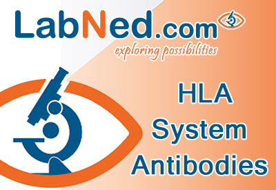 ImTec Diagnostics NV | the specialist in distributing laboratory supplies throughout Belgium and ...