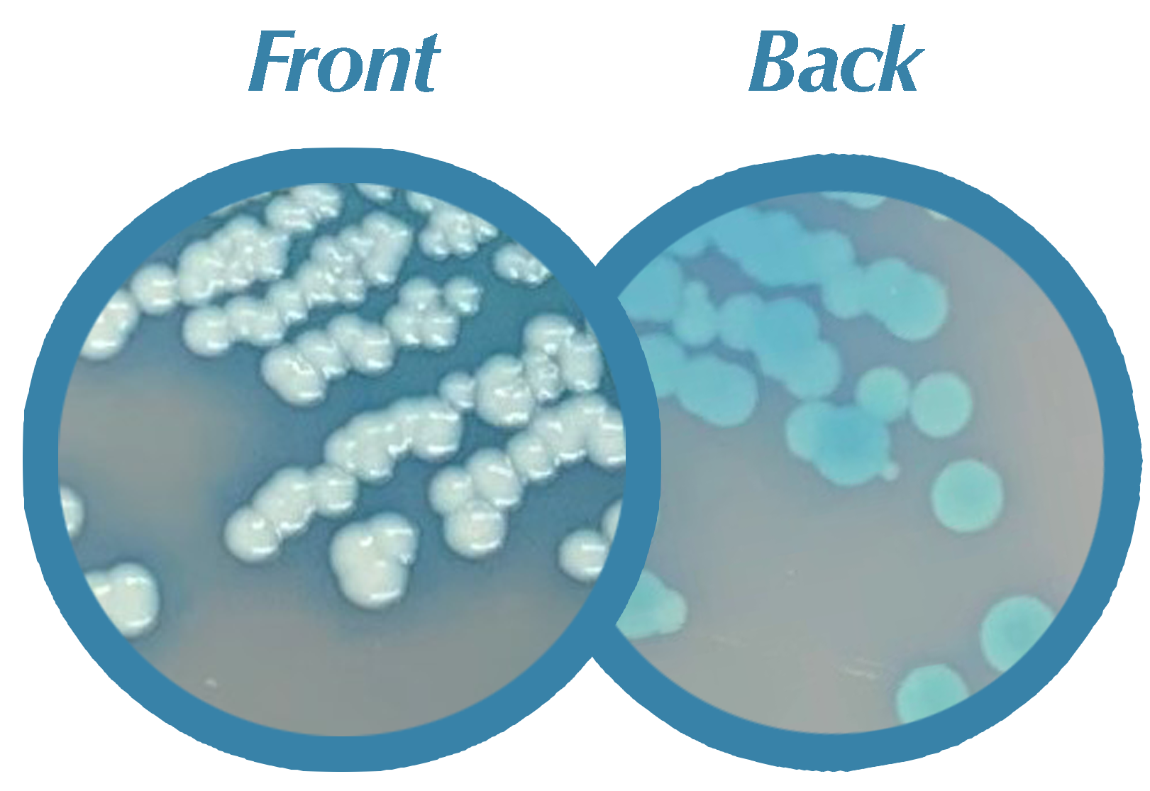 CHROMagar | ImTec Diagnostics NV